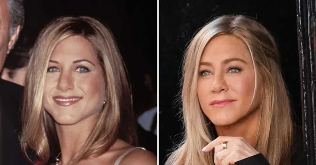 Jennifer Aniston Plastic Surgery Revelation: Botox, Fillers, and More
