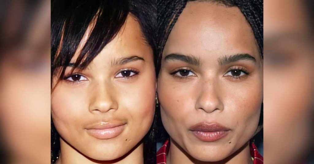 Zoe Kravitz Plastic Surgery Speculations: Unraveling the Before and After