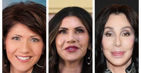 Beyond Politics: Exploring Kristi Noem's Alleged Plastic Surgery